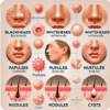 Understanding Acne: Anatomy of Skin Layers and Sebaceous Glands